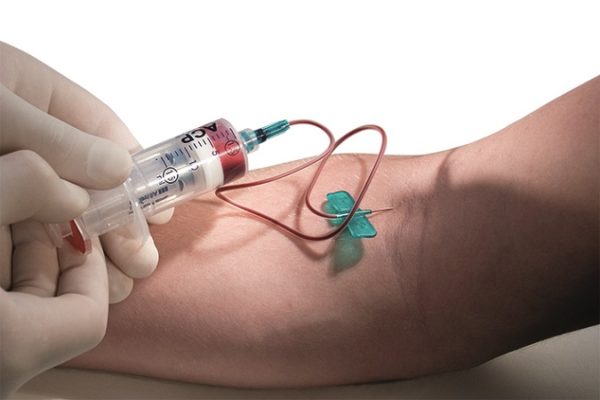 ACP-Therapie | Behandlung von Arthrose und Sportverletzungen