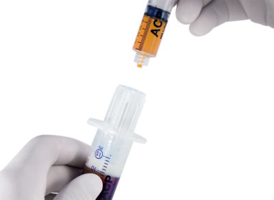 AutoCart™ Therapie zur Transplantation von körpereigenem Knorpel