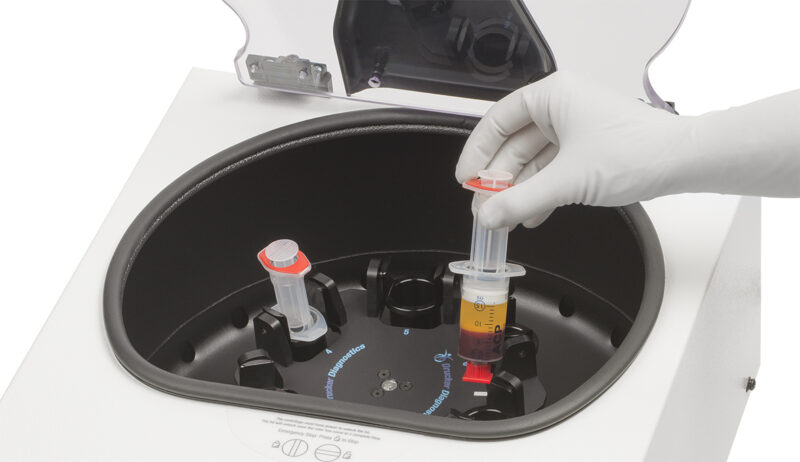 AutoCart™ Therapie zur Transplantation von körpereigenem Knorpel