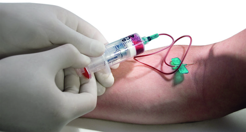 AutoCart™ Therapie zur Transplantation von körpereigenem Knorpel