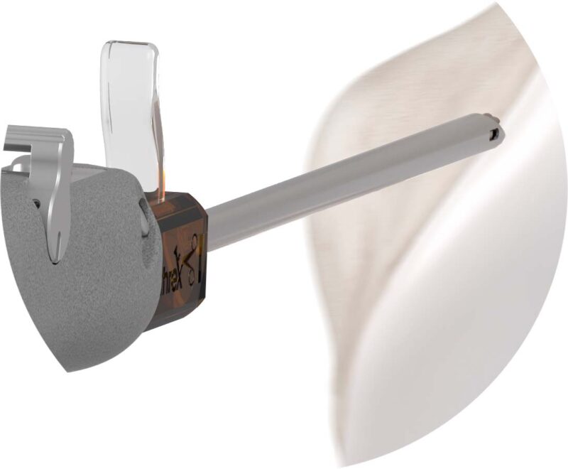 AutoCart™ Therapie zur Transplantation von körpereigenem Knorpel